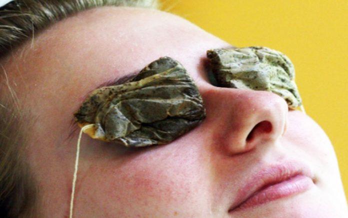 How To Get Rid of A Stye | Medicine & Home Remedies