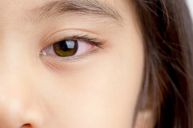 Eye Injuries In Children And How To Prevent Them